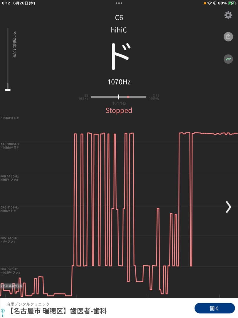 no50チベット産 シンギングボウル 新品 チベタンボウル 15cm AUM